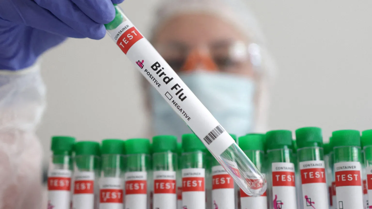 Man in Mexico dies with first human case of H5N2 bird flu - Drive ...